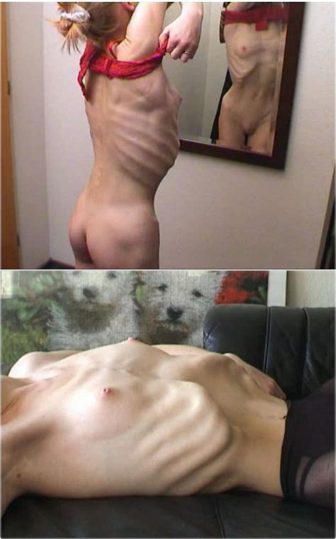 Extremely Skinny And Anorexic Softcore Posing Women Videos Page 26
