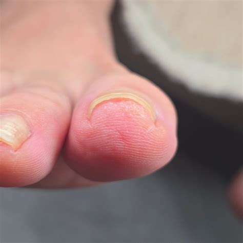 Footcareclassy Footcareclassy • Instagram Photos And Videos