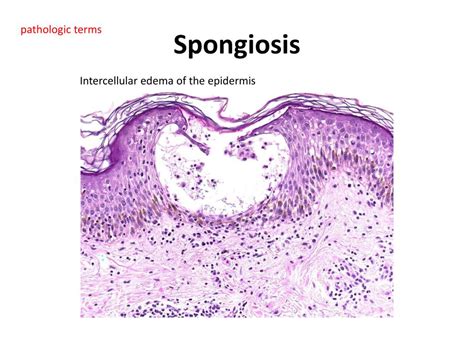 Ppt Skin Pathology Powerpoint Presentation Free Download Id 1942011