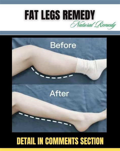 Ancient Remedies For Fat Legs A 1000 Year Tradition Of Toning And