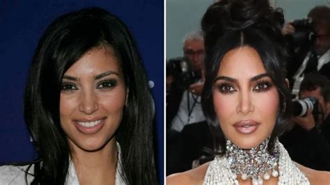 Kim Kardashian Plastic Surgery Before And After Shocking