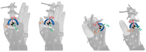 Neuroadaptive Control Of A Continuum Robot For Finger Rehabilitation