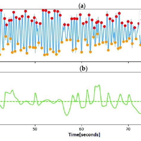 Heartbeat In Ecg Signals A Schematic Diagram Of An Ecg Of A Human Download Scientific