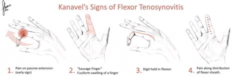 Hand Infections Teachmesurgery