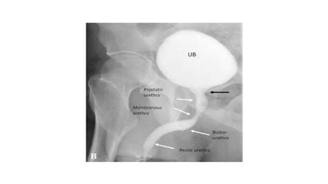 Mcu And Rgu Pptx