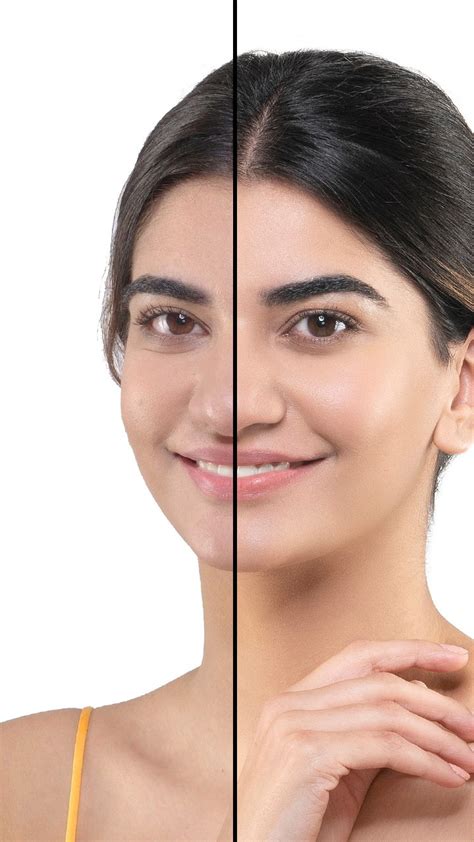 Dull Skin Before After