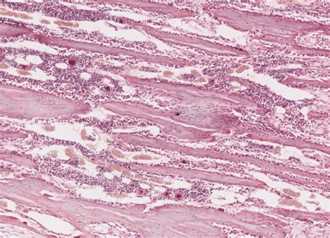 Bone Marrow Labeling Diagram Quizlet