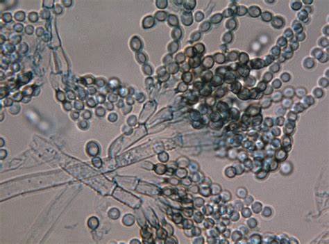 Microscopio Penicillium Roqueforti New Colours For Old In The