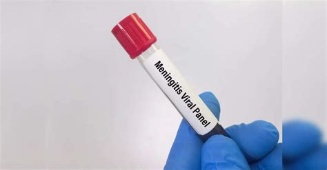 Meningitis In Gaza Doctors Alarmed At Rising Meningitis Cases In Gaza