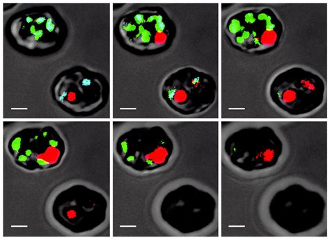 Plasmodium Falciparum Under Microscope Plasmodium Falciparum Under Microscope