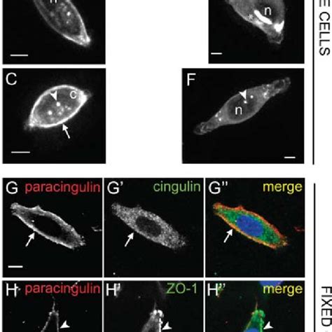 Cingulin And Paracingulin Show Distinct Localizations In Isolated Mdck
