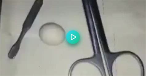 Raising A Parakeet From Broken Egg Album On Imgur