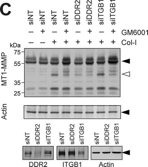 Ddr2 Antibody Unconjugated Af2538 Novus Biologicals Ddr2 Antibody Unconjugated Af2538 Novus Biologicals