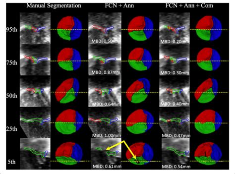 examples of segmentations predicted by the fcn from left to right