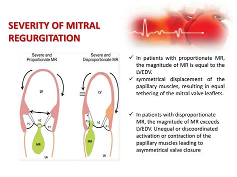 Mitral Valve Assessment Echo 110424pptx