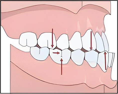 Guident Open Access Dental Journal