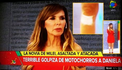 La Cantante Daniela Fue Asaltada Y Atacada Por Motochorros Fue Muy