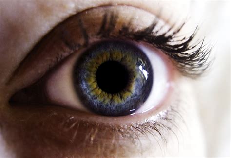 Central Heterochromia Two Colours In One Iris R Mildlyinteresting