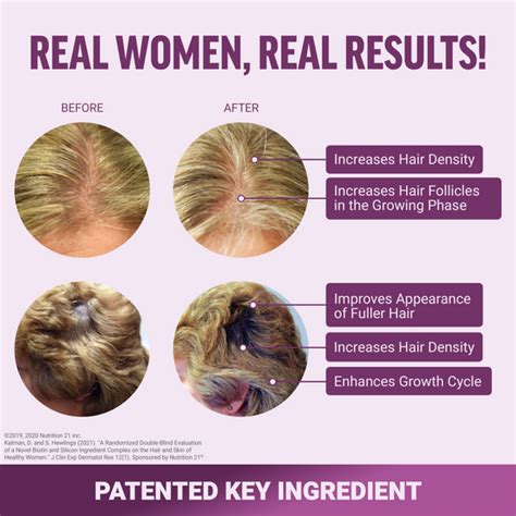 Hair Growth Accelerator Soft Chews Force Factor