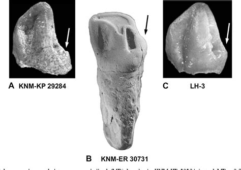 Figure 4 From Was Australopithecus Anamensis Ancestral To A Afarensis