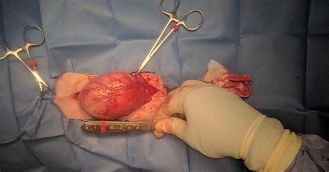 Canine Urolith Album On Imgur