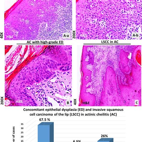Laminin Immunohistochemical Ihc Staining Of The Basement Membrane