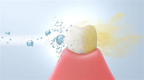 Impacting Teeth Stock Illustrations 8 Impacting Teeth Stock