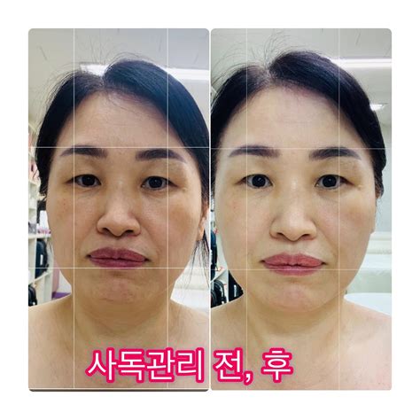 수원 엠뷰티아카데미 미용학원 사독앰플관리 미백효과 리프팅효과 비대칭관리 통증관리 슬리밍관리