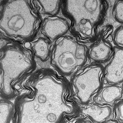 Nerfoptiquemitoyfp Blog De Paul Jorion