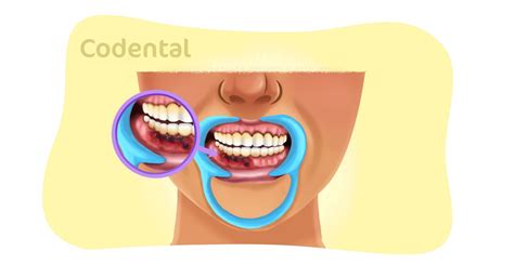Mácula Melanótica Tudo Que Você Precisa Saber