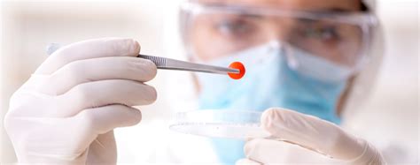 Accelerating Drug Discovery Using Knowledge Graph Ontoforce