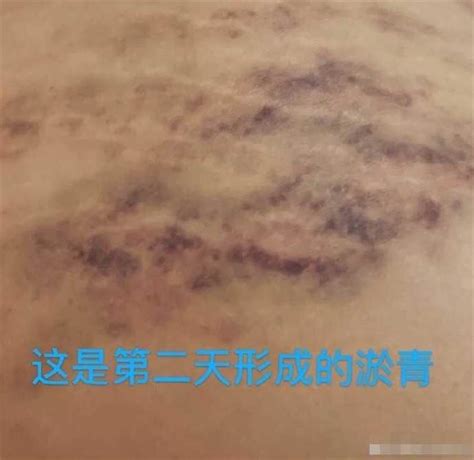 新聞 性虐待照片曝光！男星逼女友當「性奴」關籠逼舔馬桶「身上鞭打出名字」 看板sex Ptt網頁版