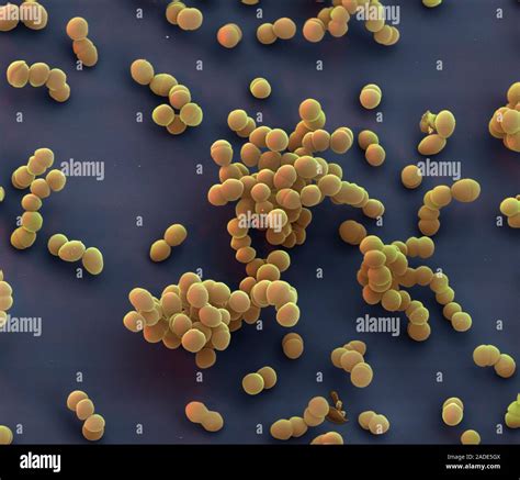 Enterococcus Faecalis Bacteria Coloured Scanning Electron Micrograph