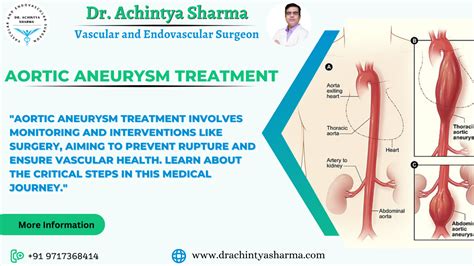 The Impact Of Aortic Aneurysm Treatment On Your Health