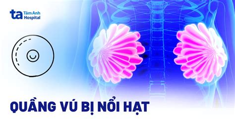 Ngực Xệ Là Gì Nguyên Nhân Và Dấu Hiệu Vú Bị Chảy Xệ Cần Lưu ý