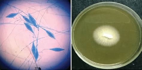 Lpcb Mount And Culture Of Microsporum Canis Download Scientific Diagram