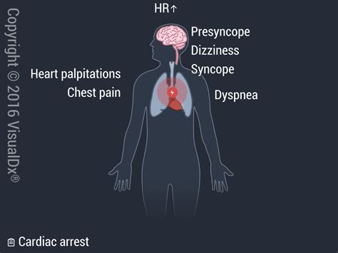 Image Iq 42 Year Old Man With Dizziness And Racing Heartbeat