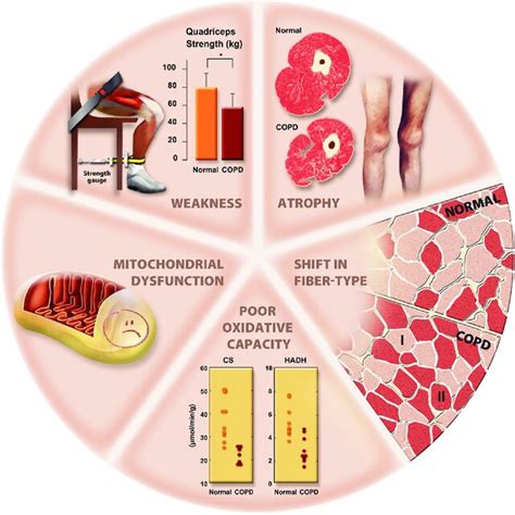 Morphological And Structural Alteration In Limb Muscle Of Copd Copd Download Scientific