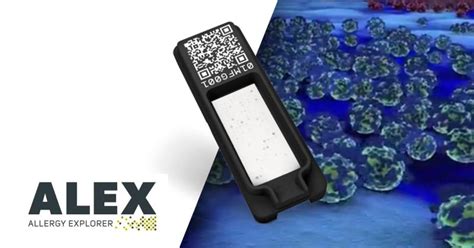 Alex Allergy Explorer Il Primo Test Allergologico In Vitro