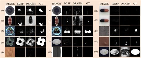 Figure From Self Supervised Guided Segmentation Framework For Unsupervised Anomaly Detection