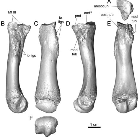 Might Be For A Sesamoid In The M Fibularis Longus Tendon As