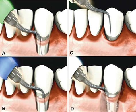 Schematic Showing Various Modes Of Operation A Tip In Contact With