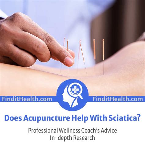 Does Acupuncture Help With Sciatica Health Coachs Advice