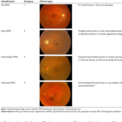 Demonstration Of The Classification Of Amd According To Areds