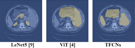 Class Activation Maps In Lenet5 9 Vit 4 And Tfcns By Using The Cam Download Scientific