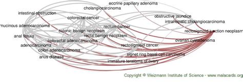 Rectosigmoid Junction Neoplasm Disease Malacards Research Articles