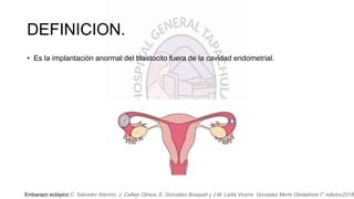 Embarazo Ectopico Definicion Factores De Reisgopptx