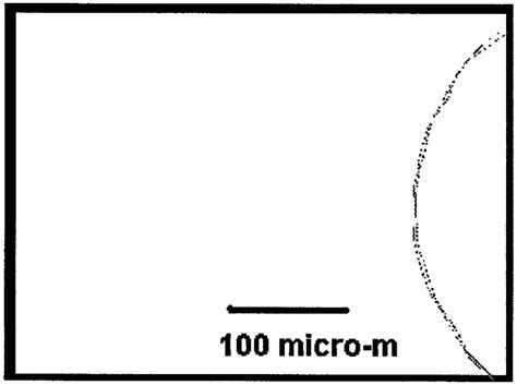 Typical Microstructures Observed On Serial Sections Transverse In The