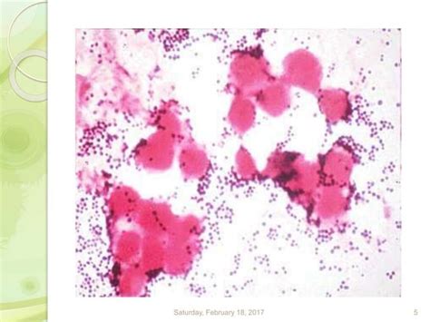 Laboratory Diagnosis Of Staphylococcus Pptx Infectious Diseases Diseases And Conditions