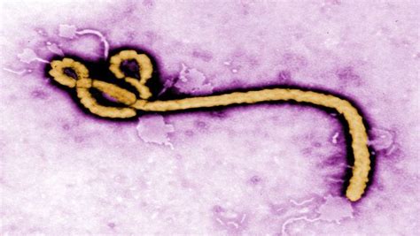 How The Human Immune System Protects Against Ebola